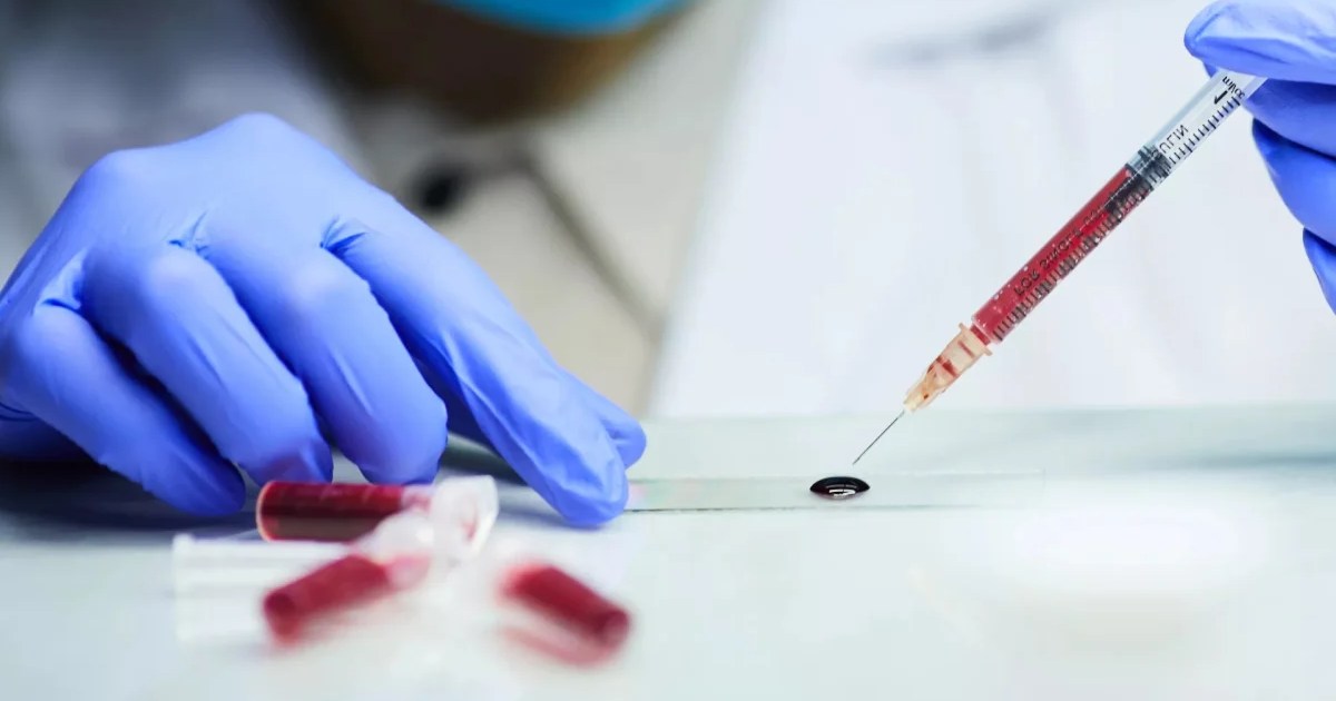 ¿Antidoping para políticos?: cómo es el proyecto que presentaron desde ...