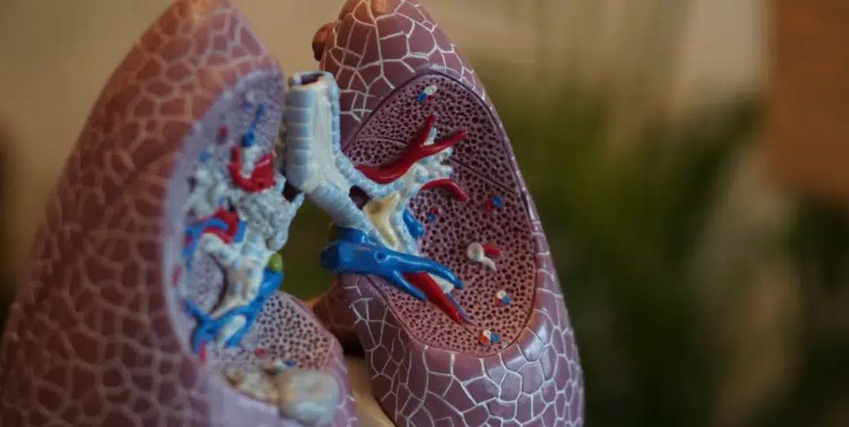 Fibrosis quística: Salud incorporó terapia moduladora y botiquines para ...