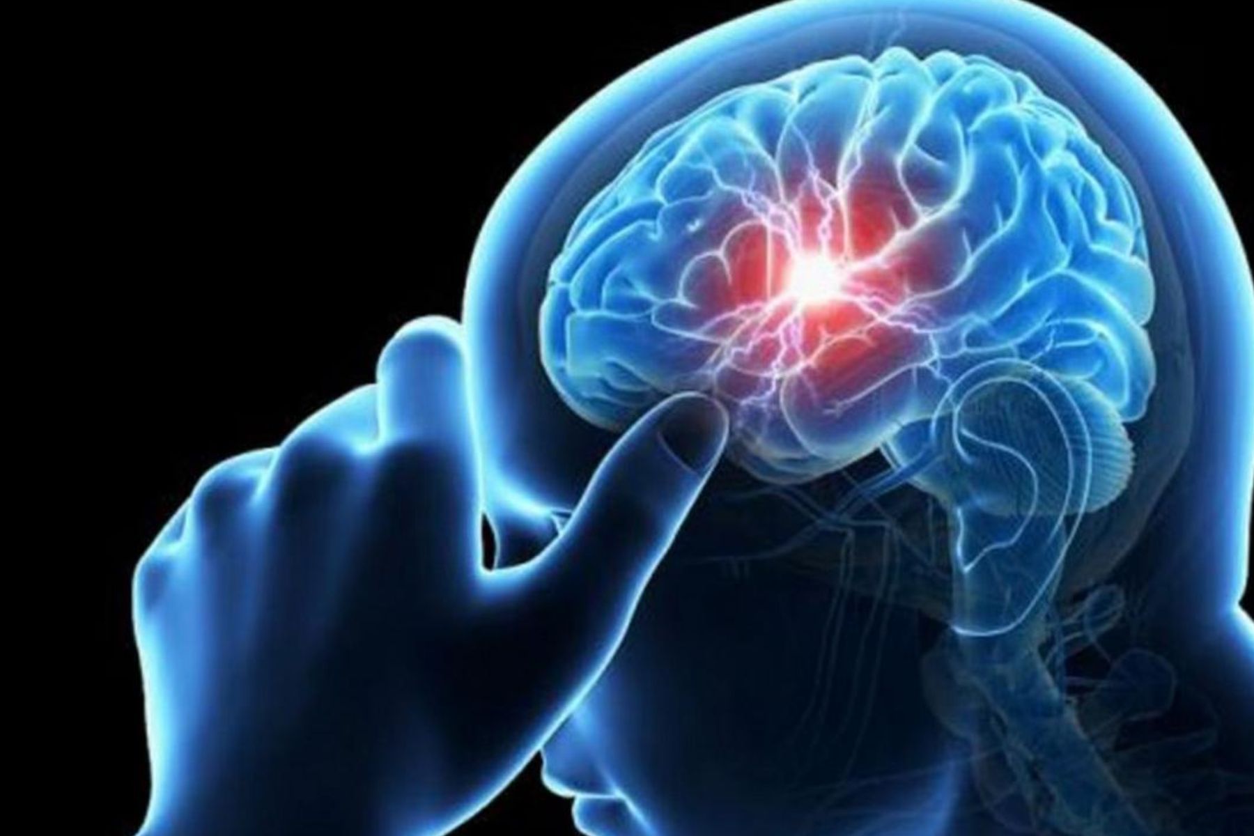 Día mundial del ACV | En el 90% de los casos se puede prevenir: qué ...