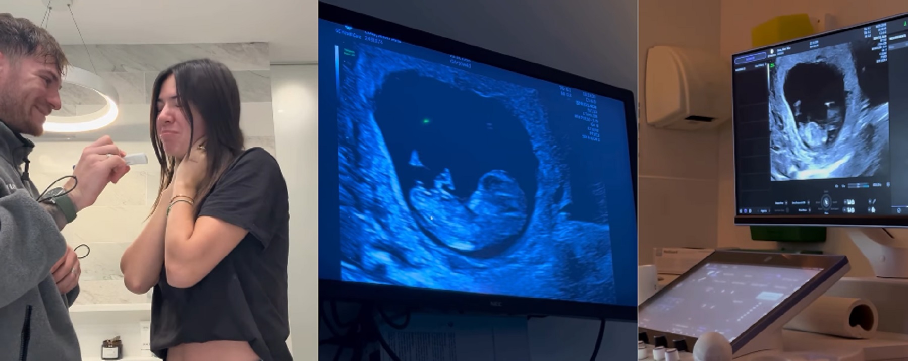 ¡Alexis Mac Allister será papá! espera su primer hijo con Ailén Cova ...