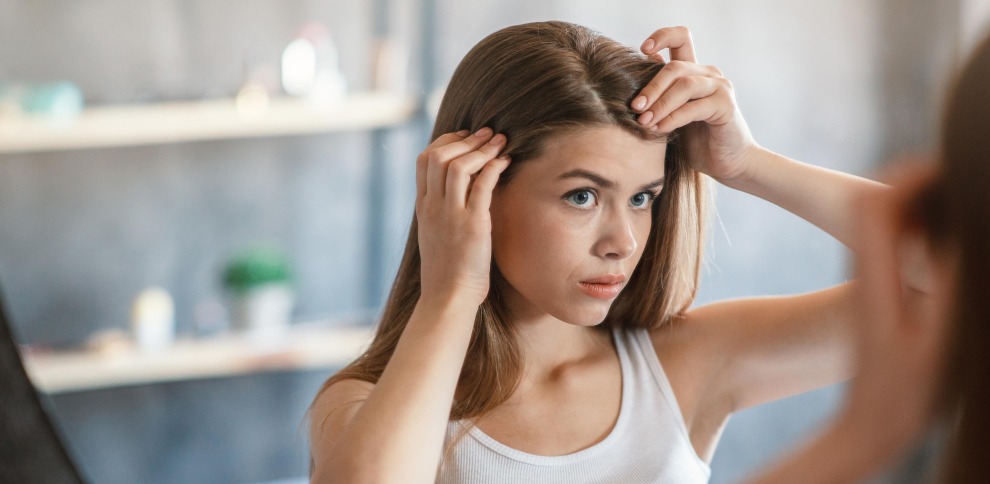 Cómo hacer un champú casero que elimina la caspa y revitaliza el pelo ...