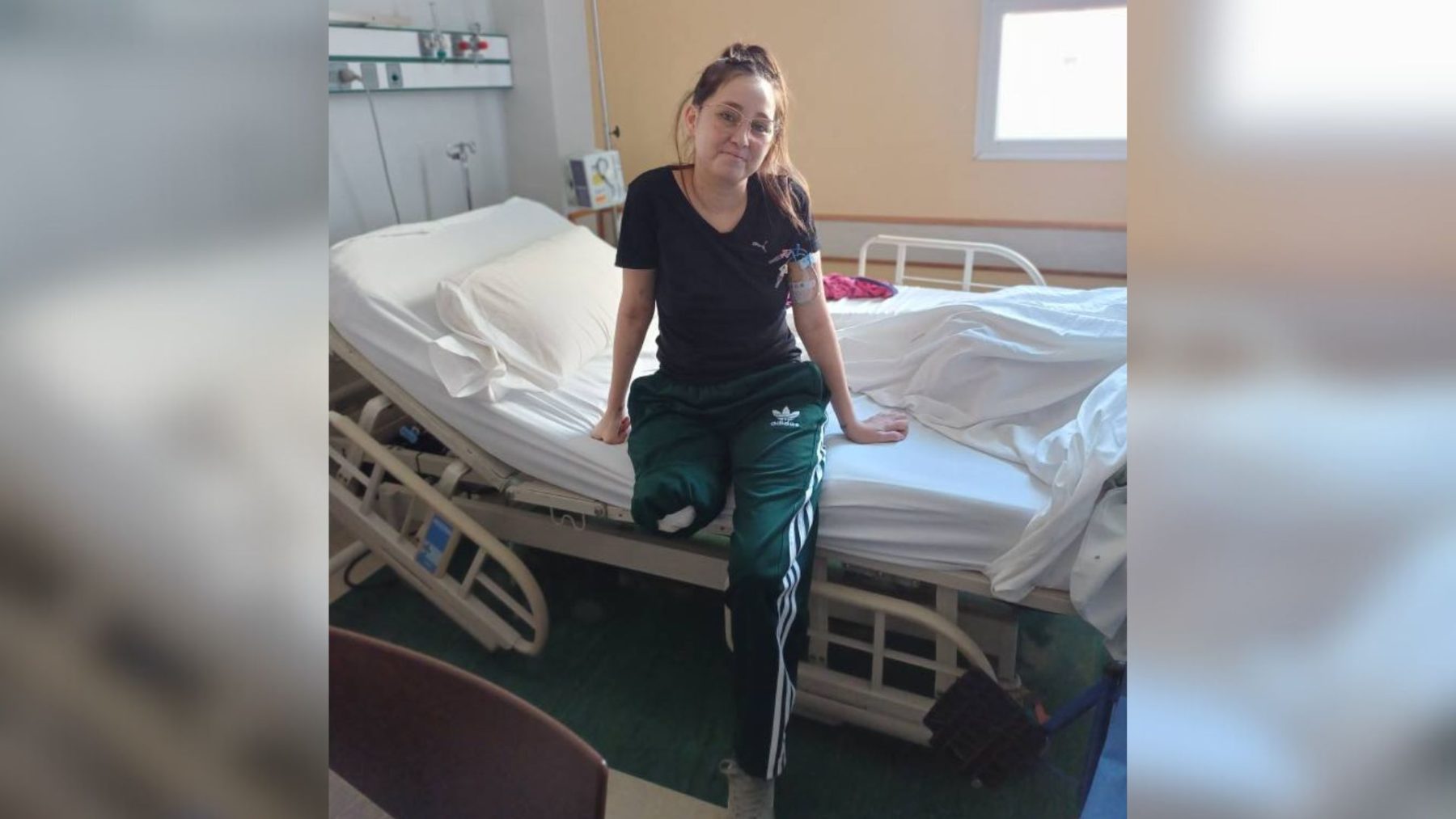 Alison relató cómo es su día a día luego de la llegada de la prótesis ...